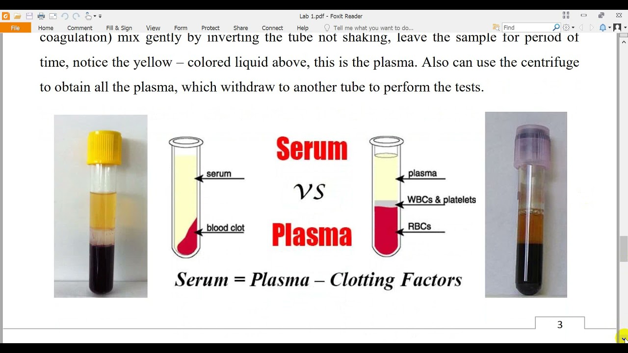Practical Physiology Lab 1 Blood Physiology Youtube
