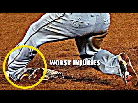 Injuries In Baseball Compilation Mlb 3 Youtube