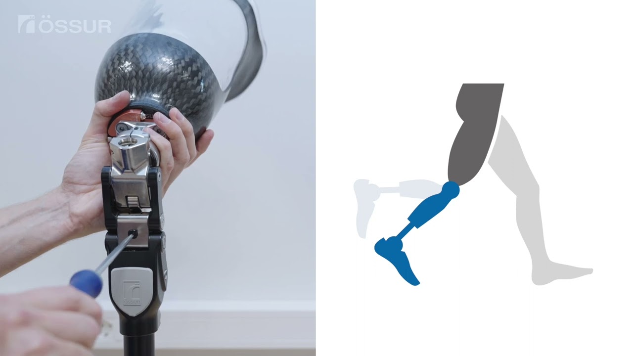 Total Knee 1900 Clinician Fitting Tutorial Youtube