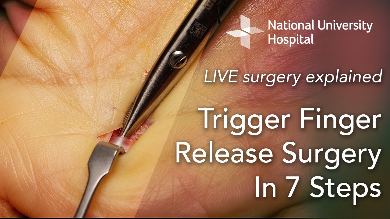Live Surgery Explained Trigger Finger Release Surgery In 7 Steps Youtube