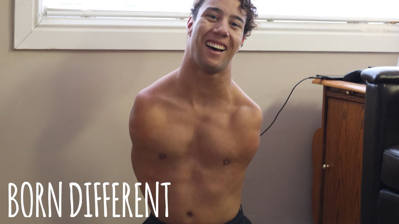 Man Born Without Arms And Legs Lives Life Without Limits Born