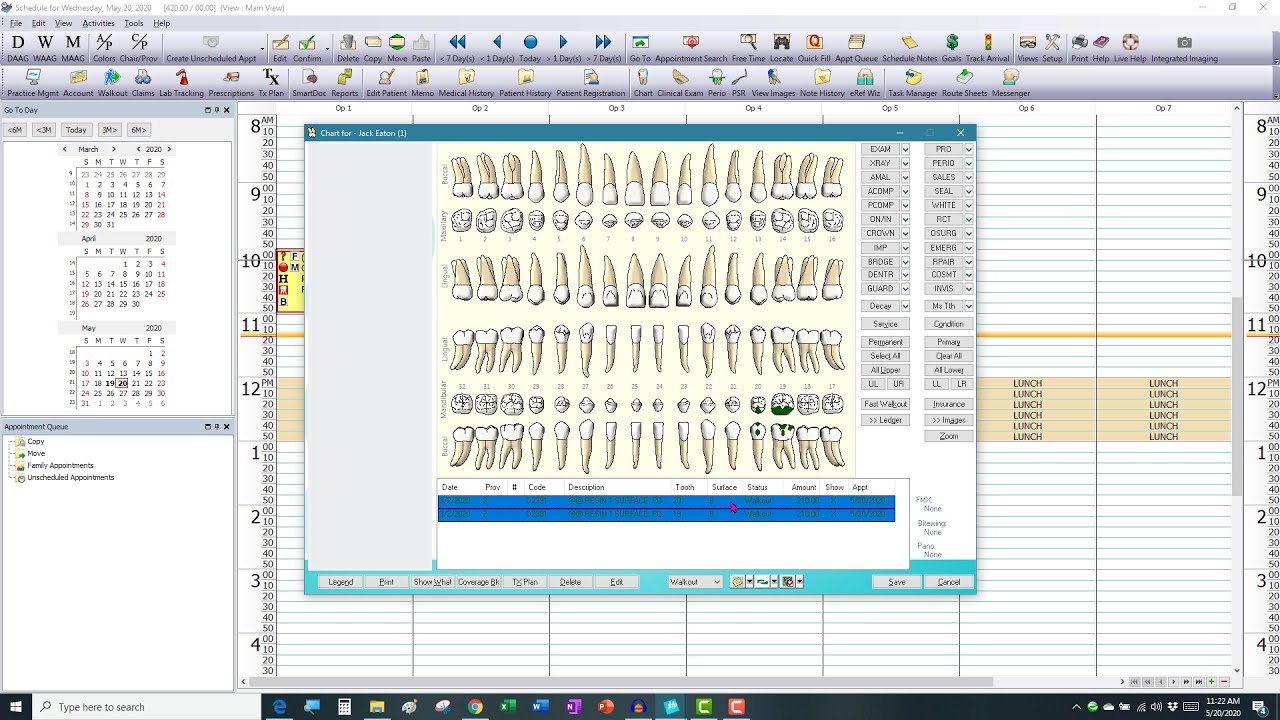 Eaglesoft Dental Patient Chart