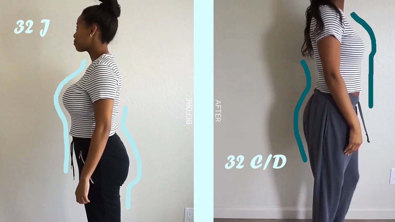 Breast Reduction Before And After In Clothes