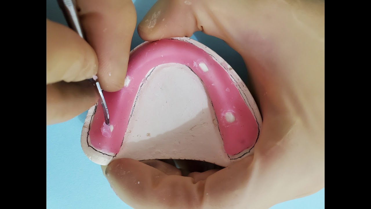 Cubeta Individual Maxilar Inferior Para Paciente Edentulo Youtube