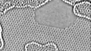 Real Atoms Under A Microscope
