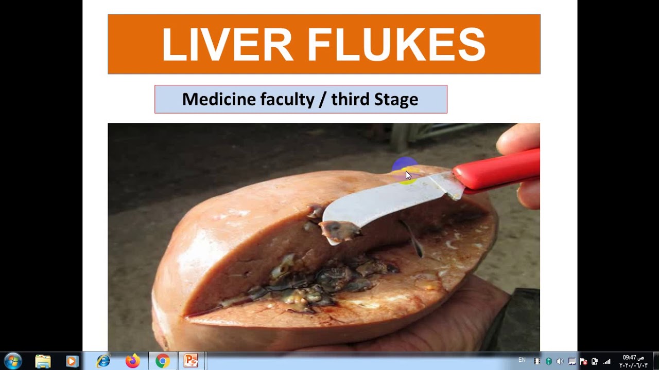 Treatment Of Lancet Liver Fluke At John Mcfadden Blog