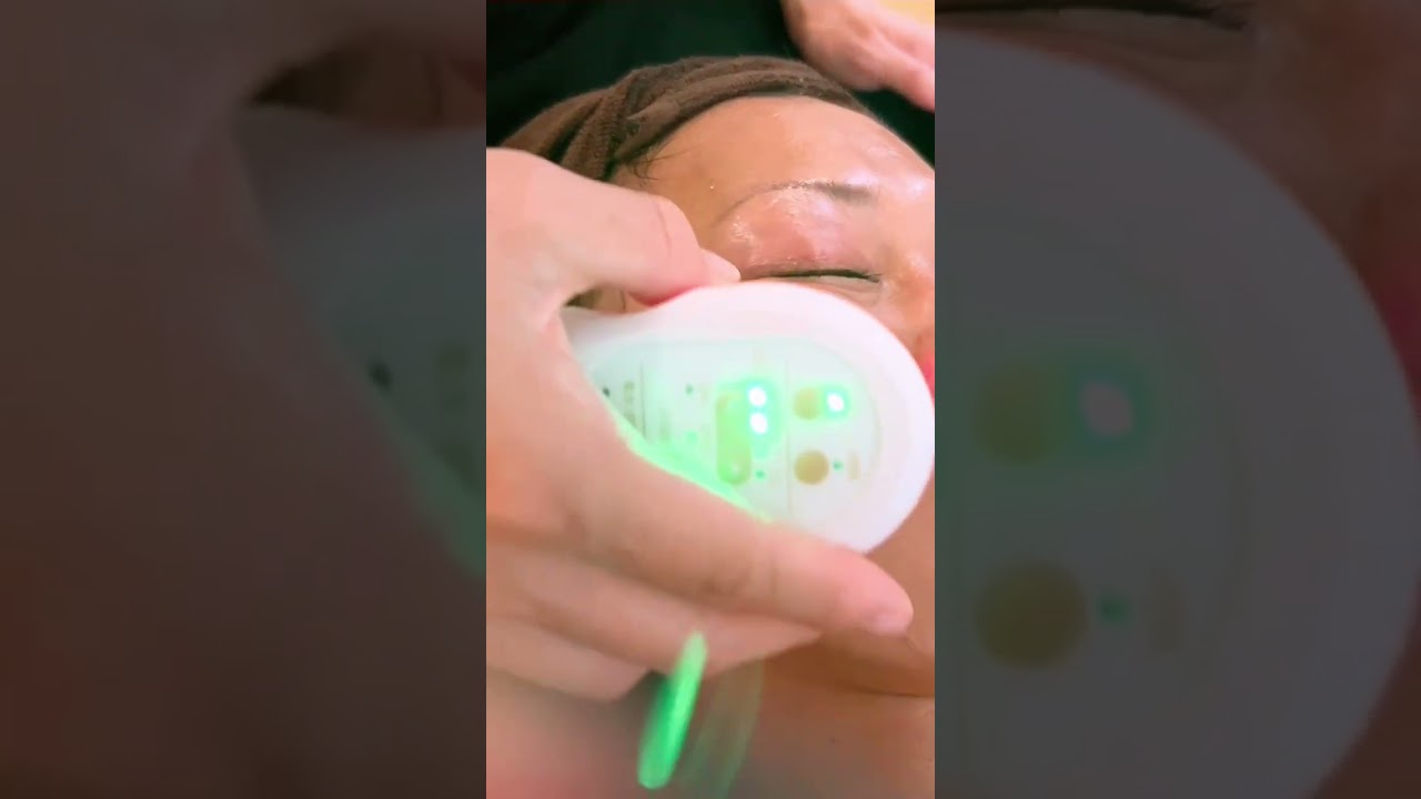 Face Lift Youtube