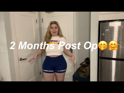 2 Month Post Op Youtube