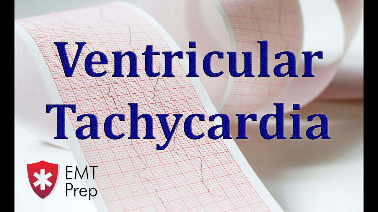 Ventricular Tachycardia Ecg Emtprep Youtube