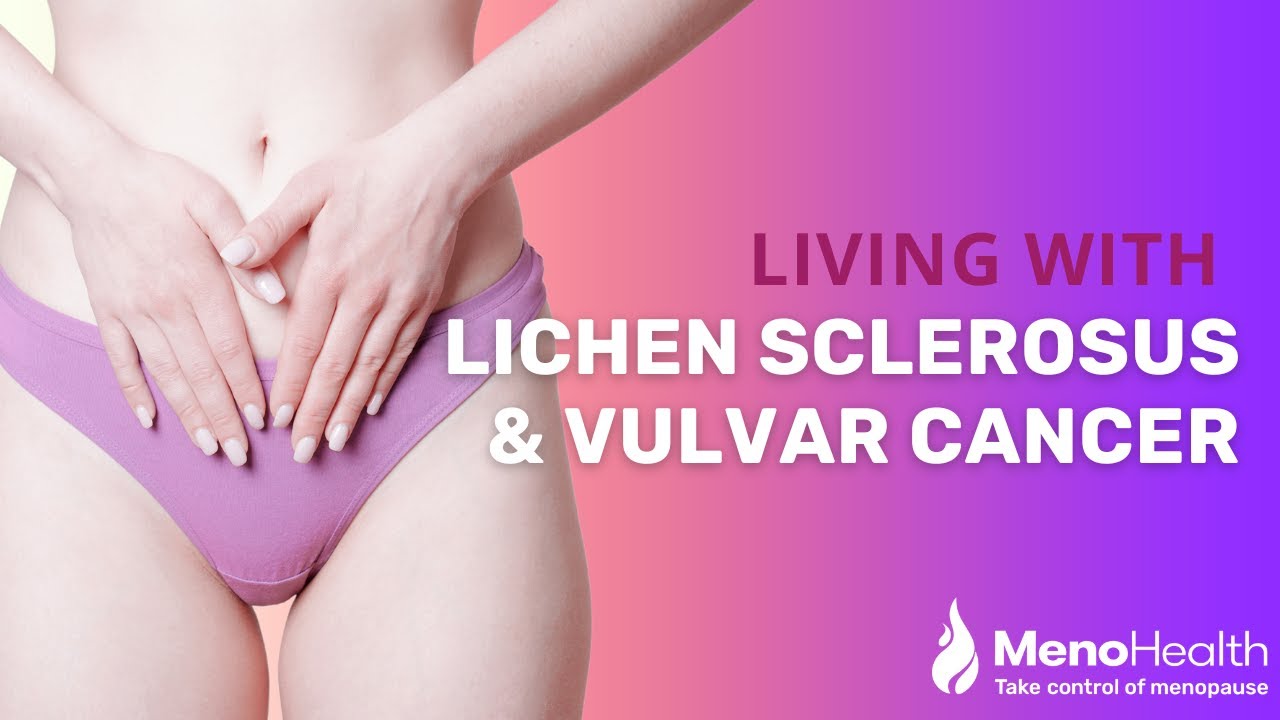 Living With Lichen Sclerosus Vulvar Cancer Youtube
