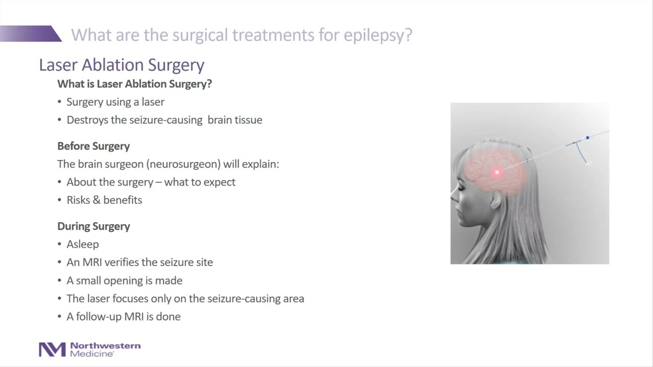 Can Epilepsy Surgery Help Surgical Treatments For Epilepsy Youtube