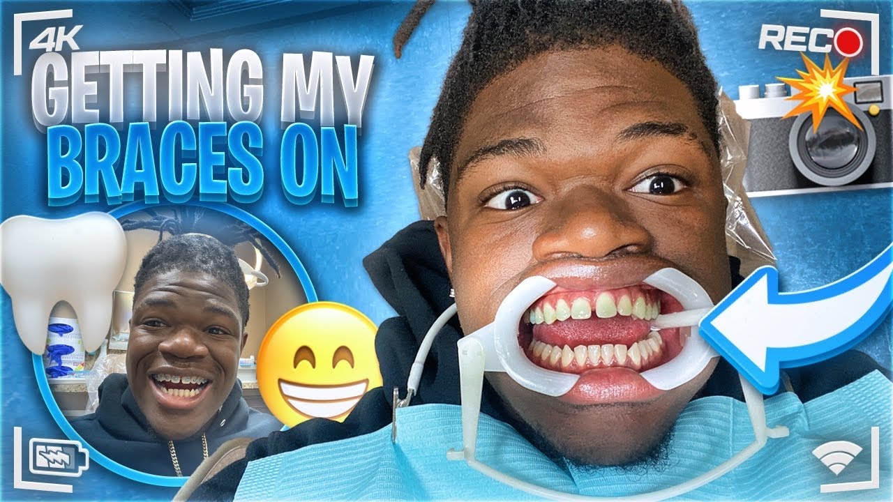 Braces Vlog It Was Painful Youtube