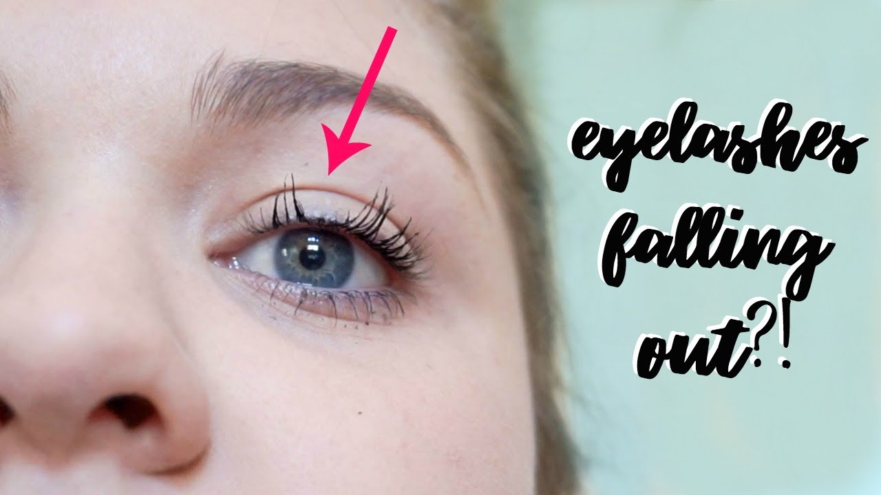 Eyelashes Falling Out