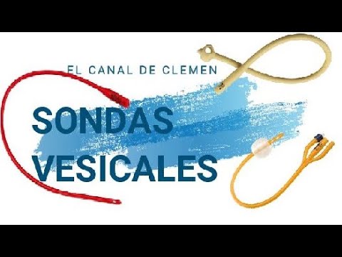 Tipos De Sonda Tiposde