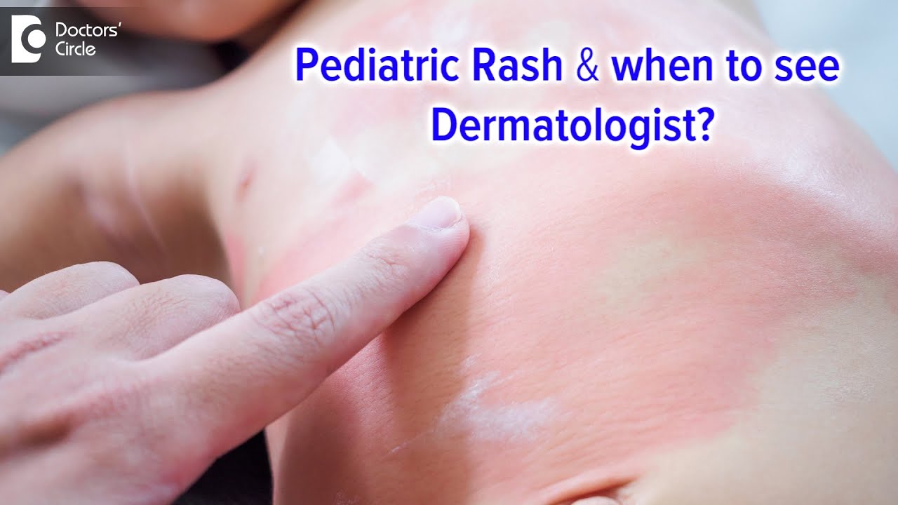 Pediatric Rash When To See A Dermatologist For Pediatric Rash Dr