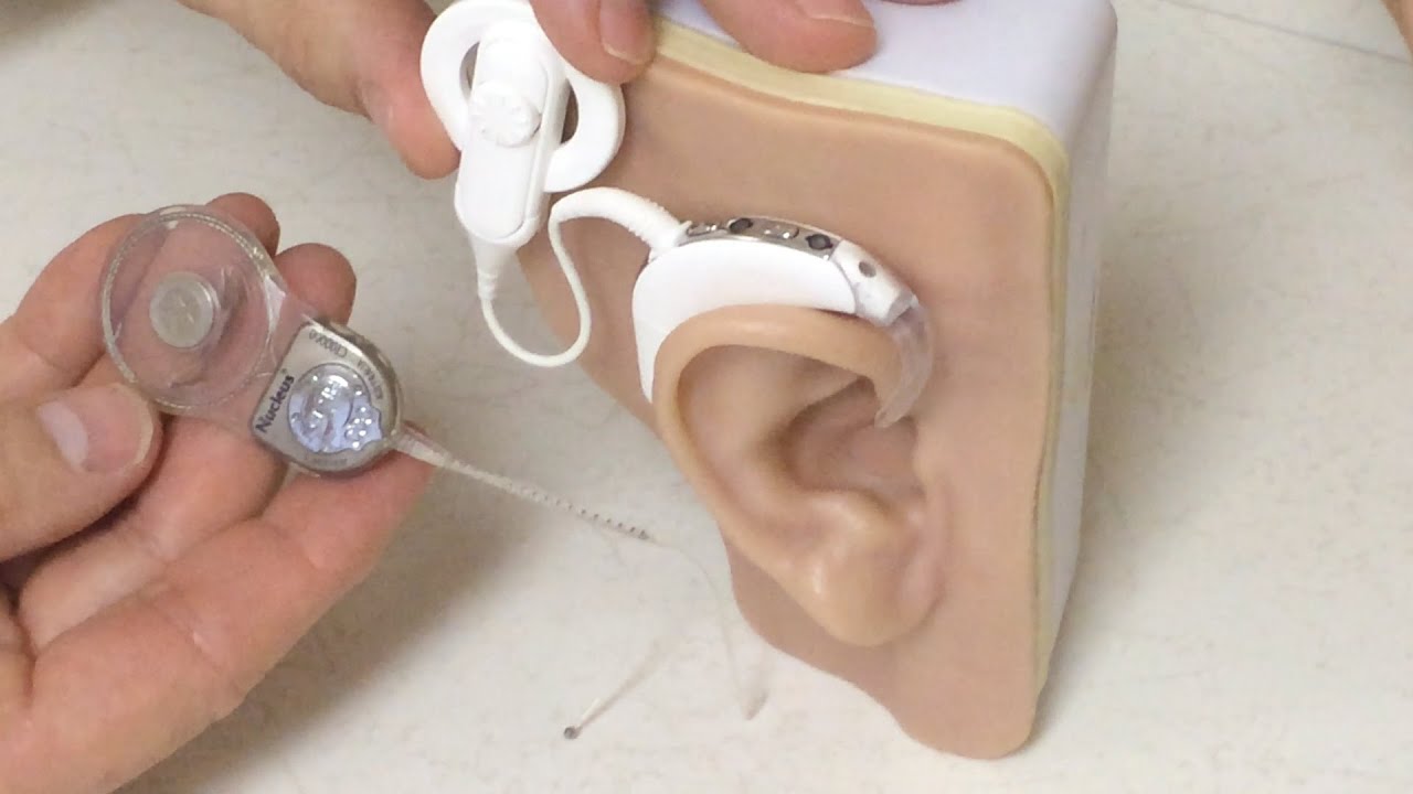 Sound Science Hybrid Cochlear Implants Youtube