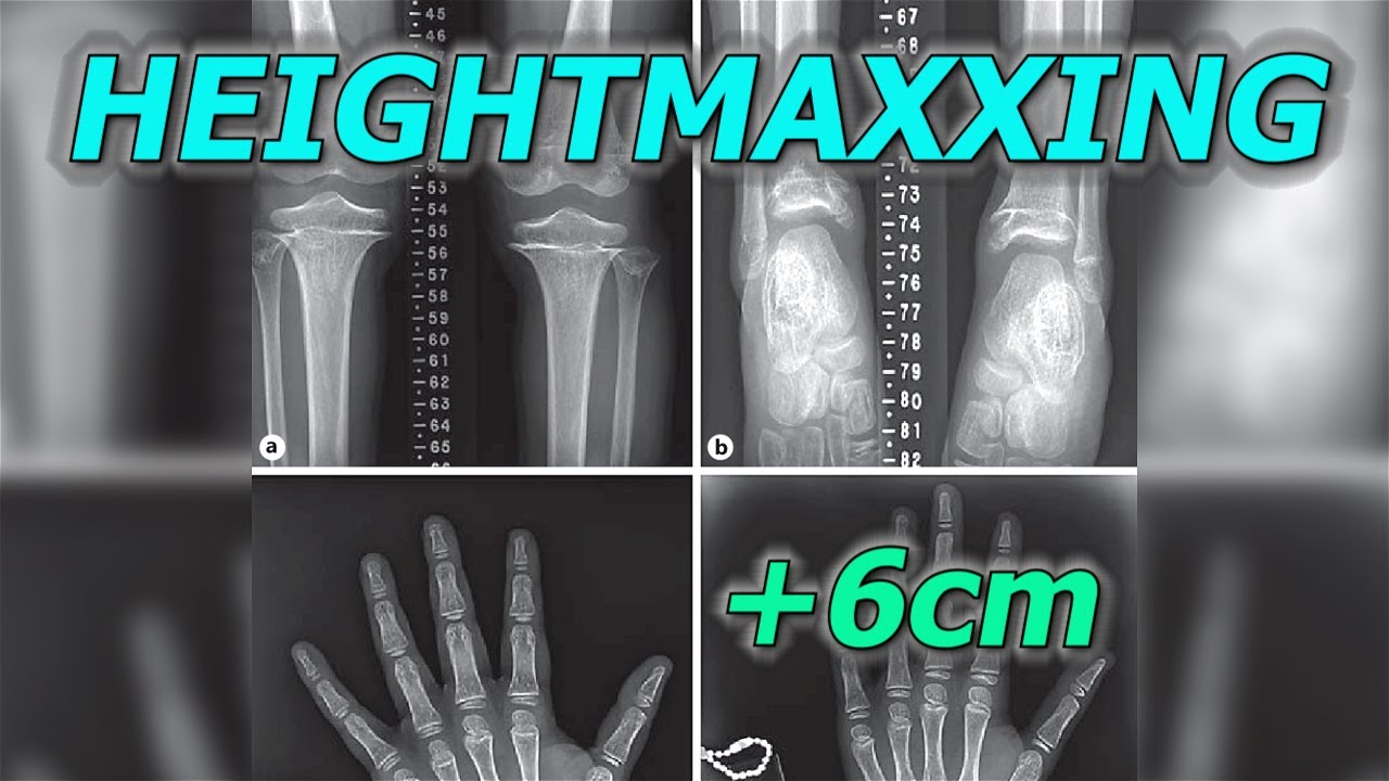 How To Reach Your Full Height Potential Heightmaxxing Youtube