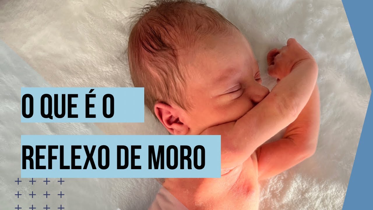 O Que é Reflexo De Moro Retoedu