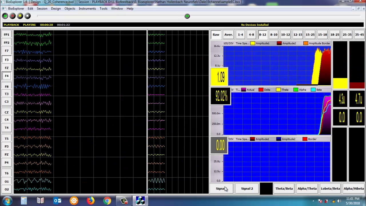 Bioexplorer 19 Electrodes Q20 Youtube