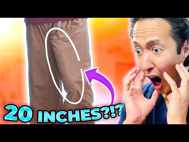 He Has The World S Largest Penis Extreme Bodies Explained 263296