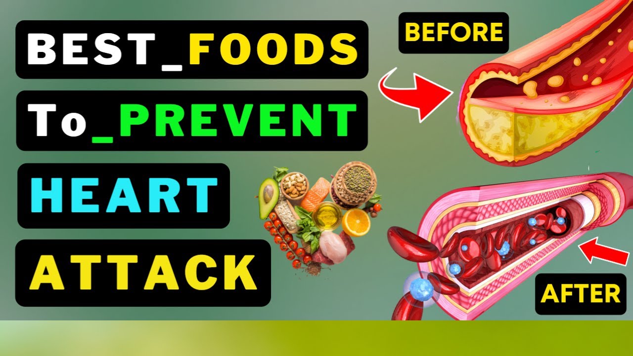 Clean Arteries 12 Foods To Prevent Heart Attack Go It