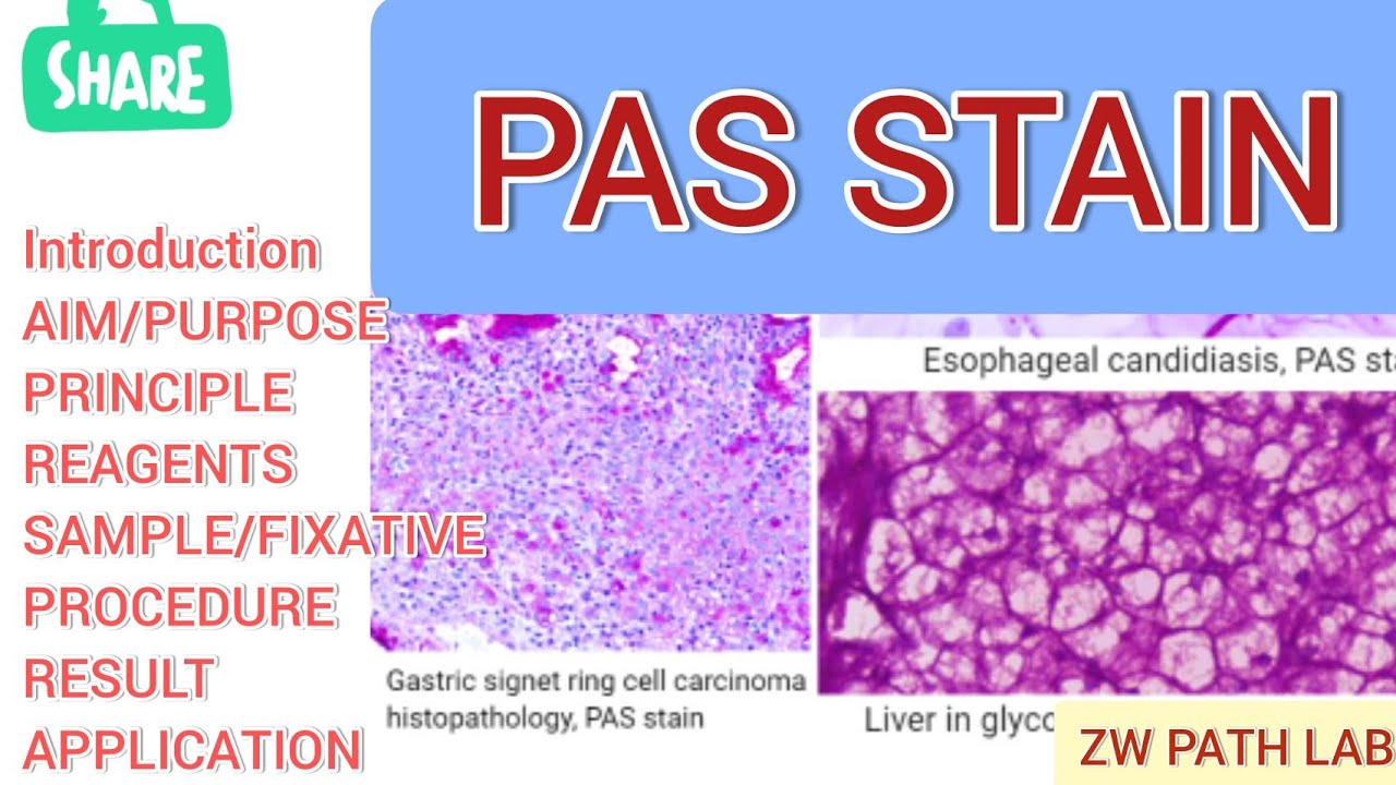 Pas Stain Histopathology Staining Histopathology Youtube