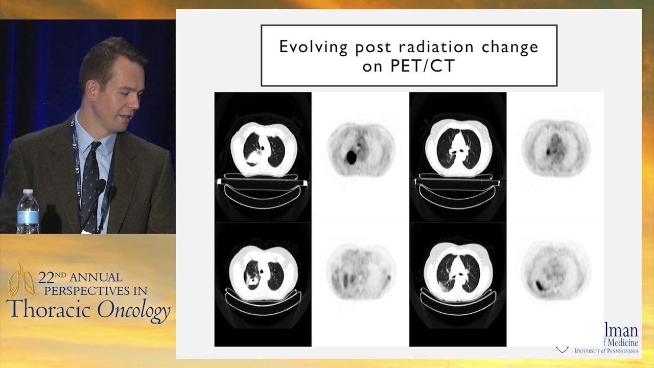 Going Beyond Positron Emission Tomography Pet New Imaging Approaches