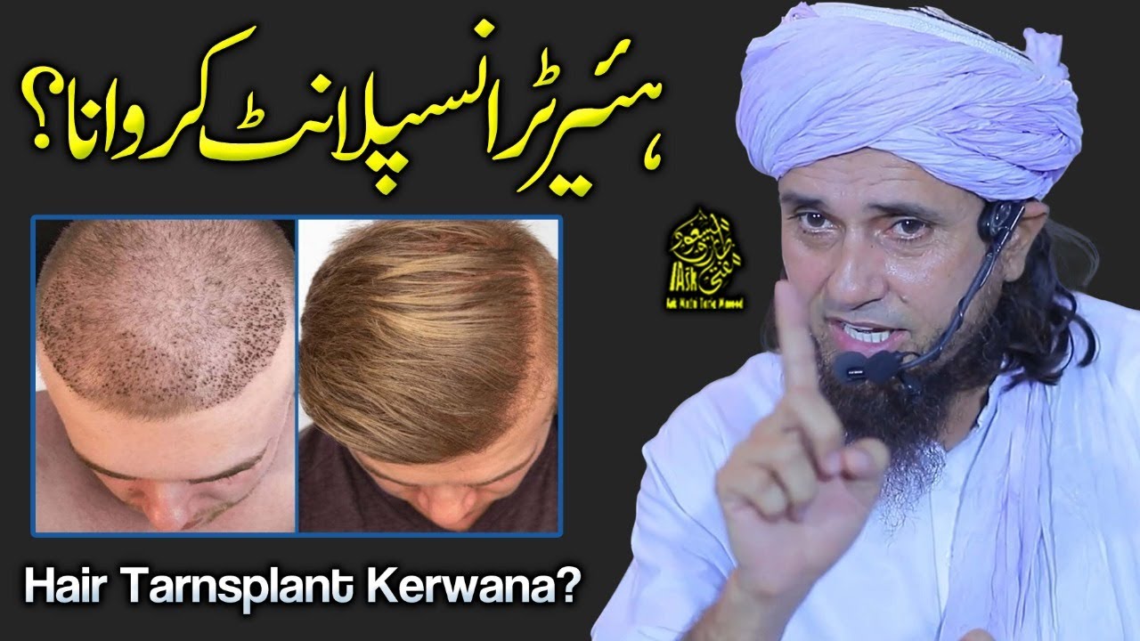 Hair Transplant Karwana Ask Mufti Tariq Masood Youtube
