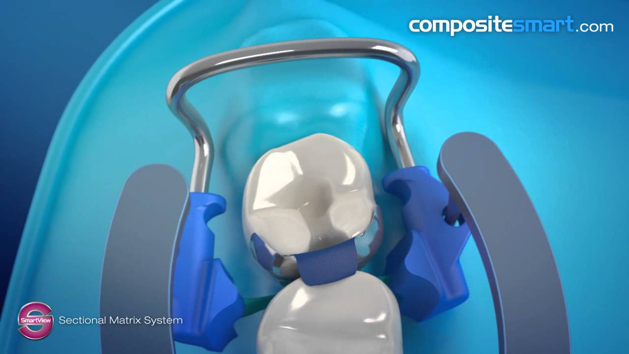 Smartview Sectional Matrix System By Compositesmart Youtube