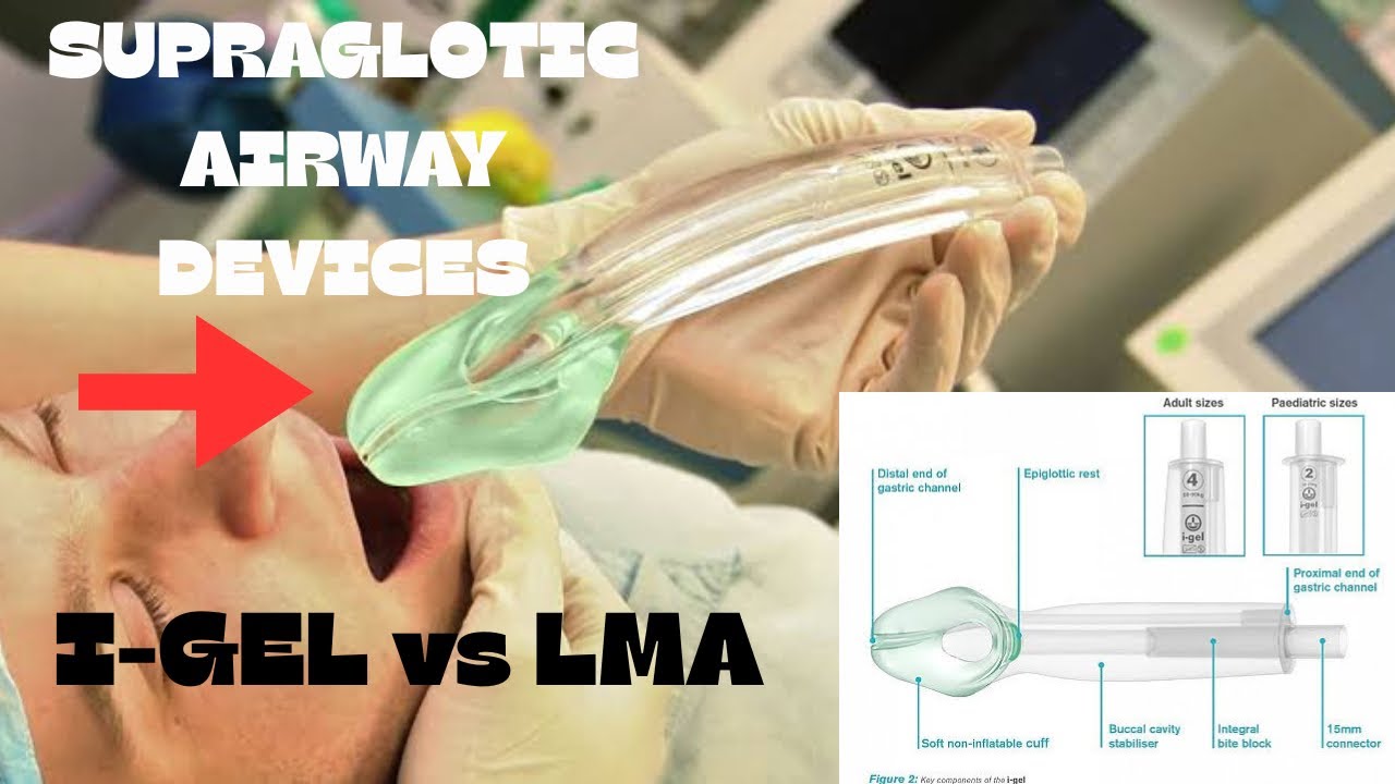 Supraglottic Airway Devices Made Simple I Gel Vs Lma Explained Youtube