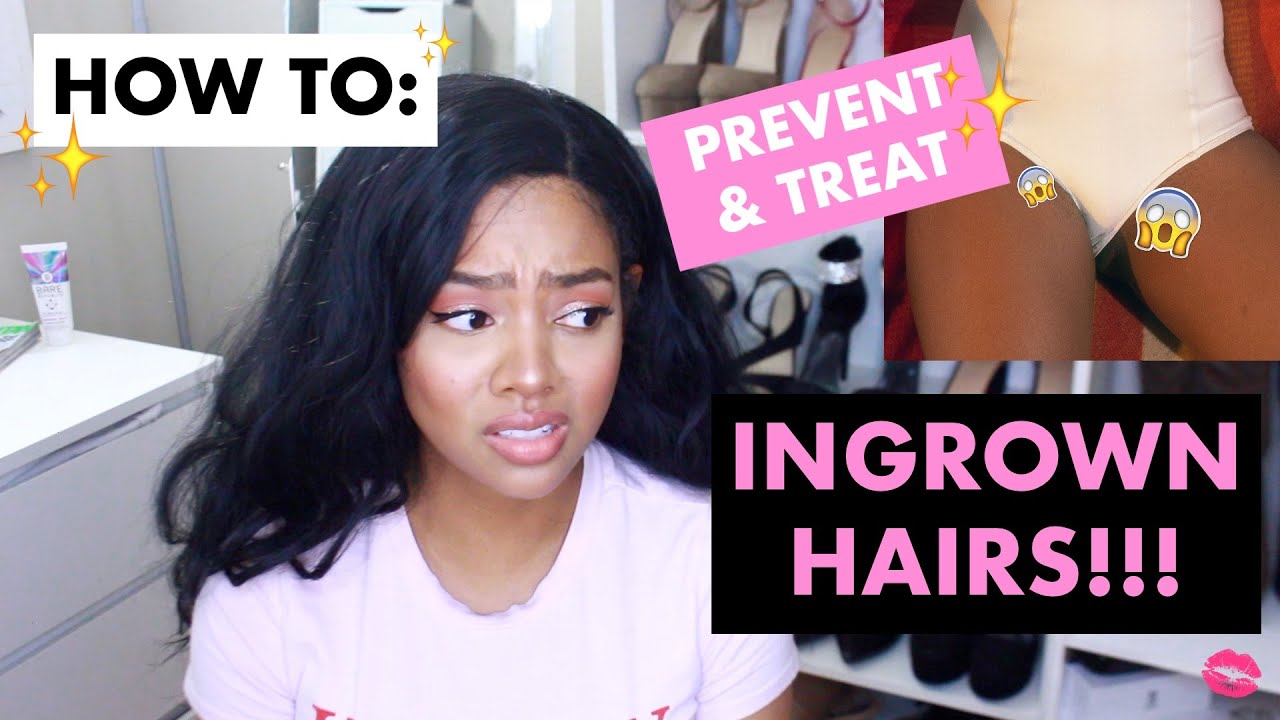How To Prevent And Treat Ingrown Hairs Youtube