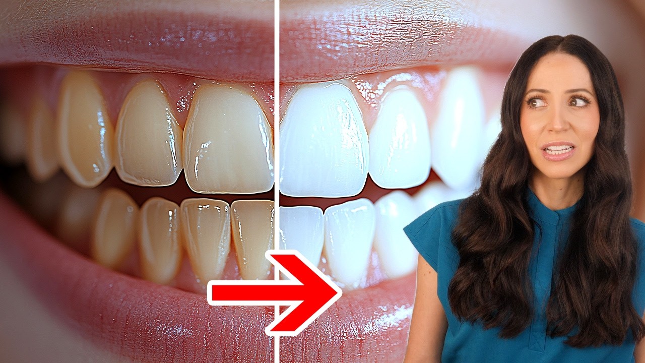 If You Have Stained Teeth Do This Youtube