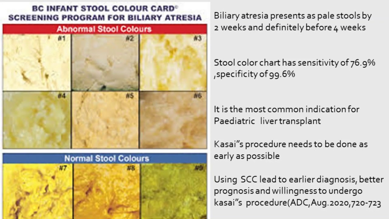 12 Free Printable Stool Color Charts Word Pdf Medical Stool Color