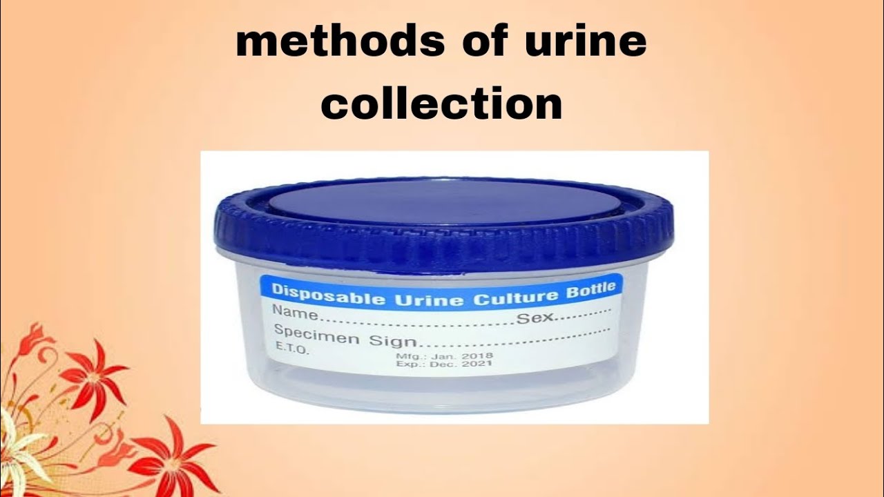 Urine Specimen