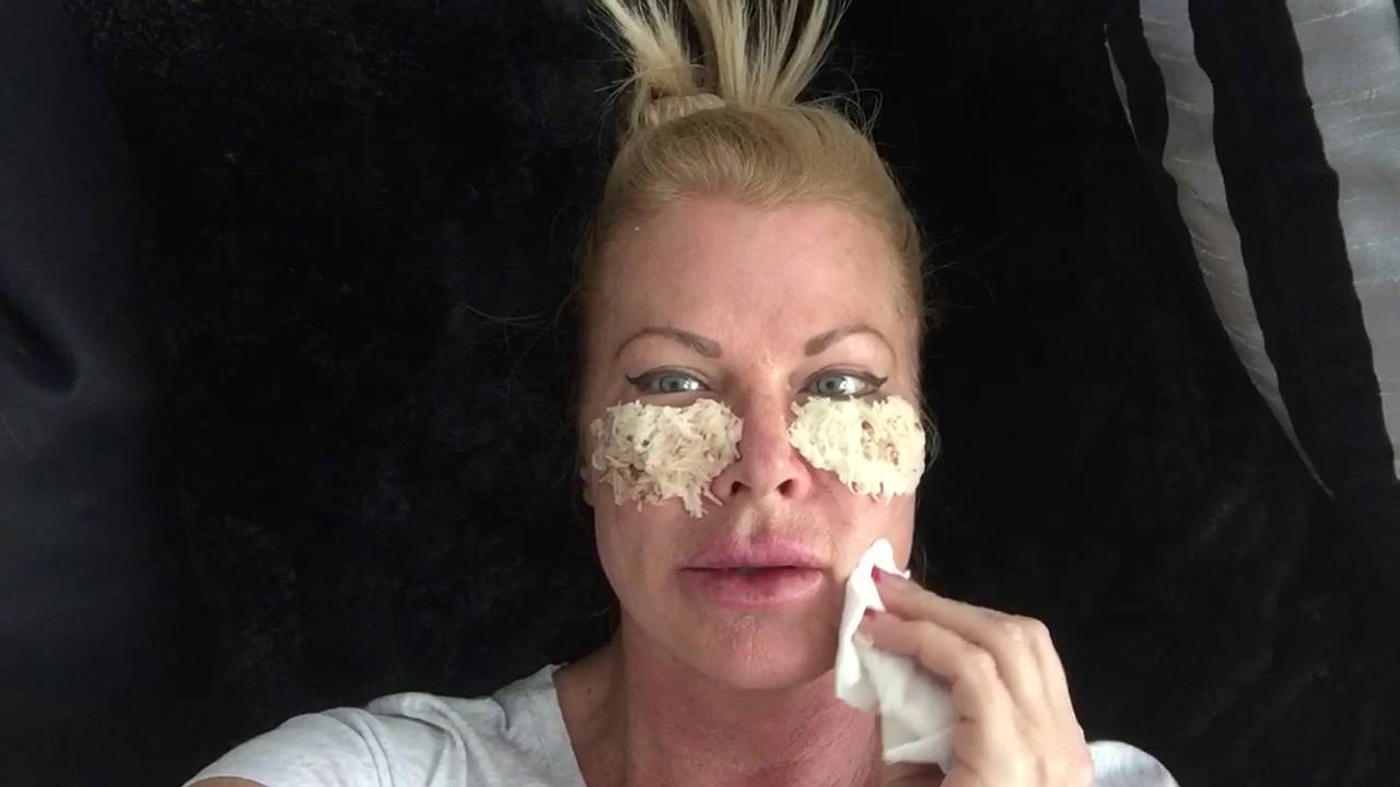 Beauty Treatment Gone Wrong Youtube