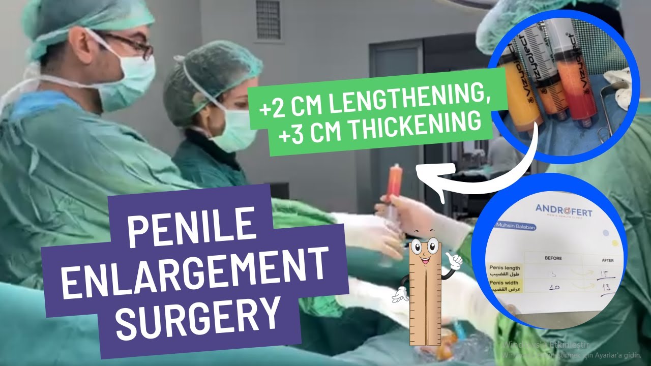 Penile Enlargement Surgery 2 Cm Lengthening 3 Cm Thickening Youtube