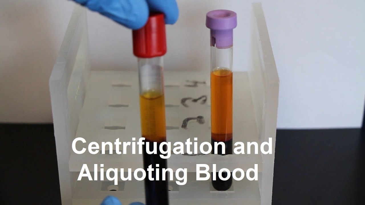 Centrifugation And Aliquoting Of Blood Serum And Plasma Youtube