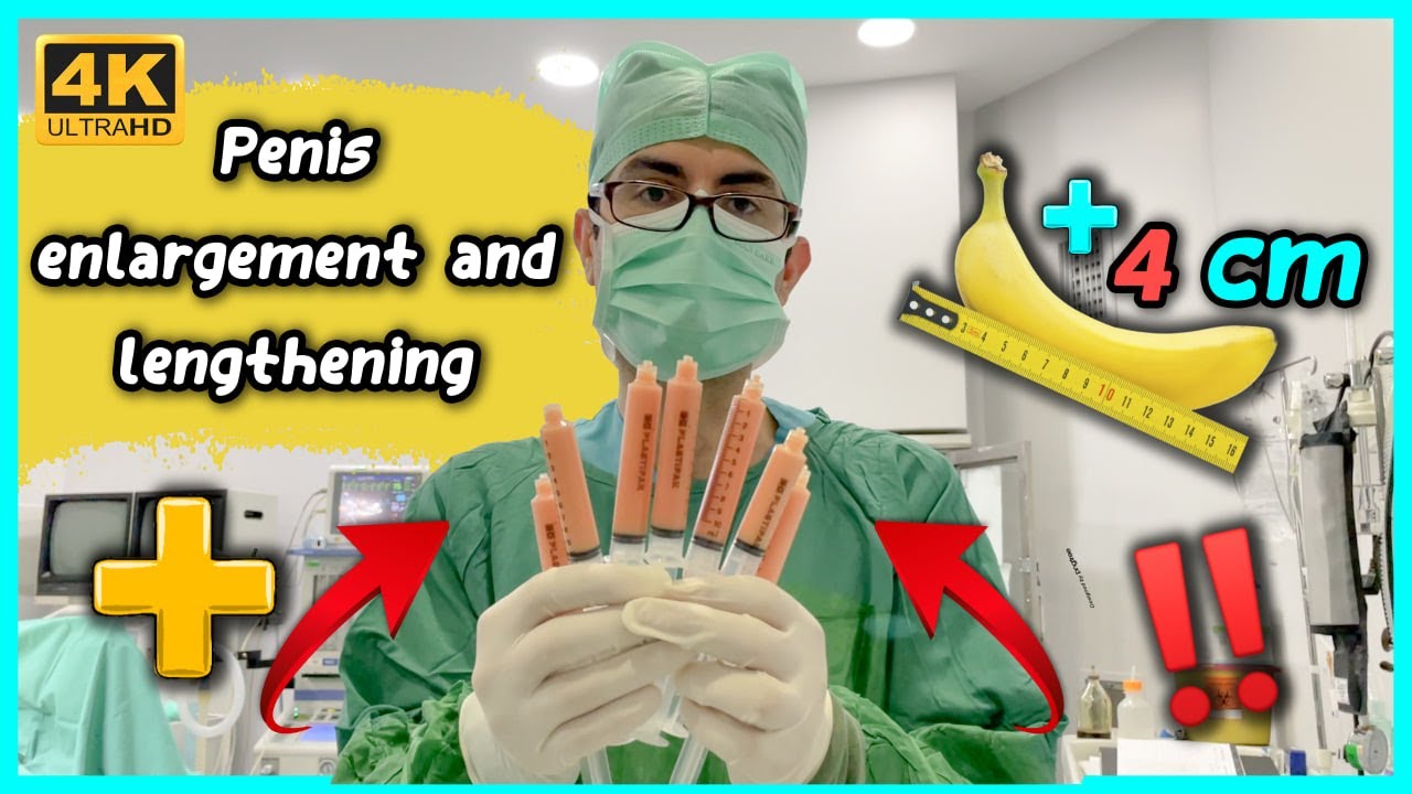 Penile Enlargement Surgery 3 Cm Lengthening 4 Cm Thickening Youtube