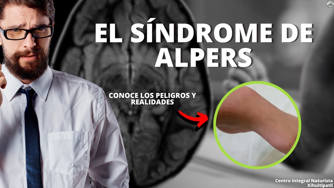 Alerta Todo Lo Que Debes Saber Sobre El Síndrome De Alpers Una