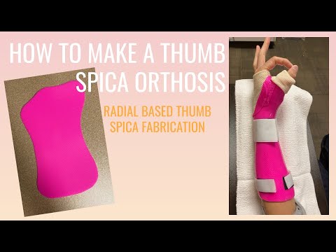 How To Make A Thumb Spica Splint Youtube