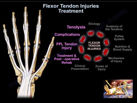 Flexor Tendon Injuries Treatment Everything You Need To Know Dr