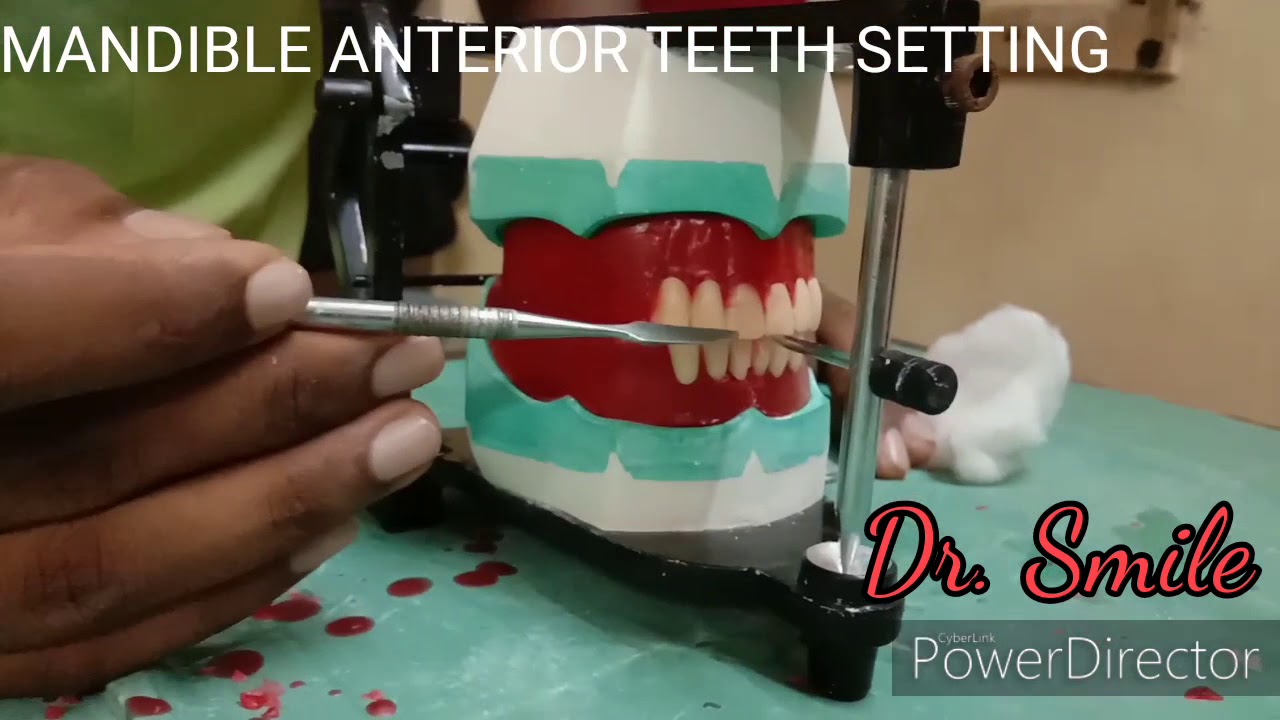 Mandible Anterior Teeth Setting Youtube