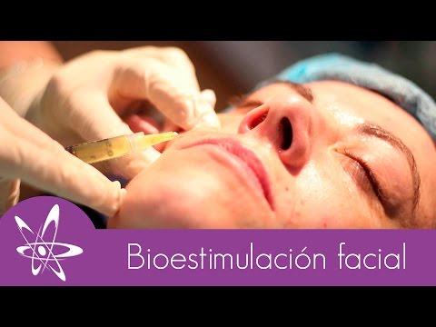 Bioestimulación Facial Una Técnica Anti Age Natural