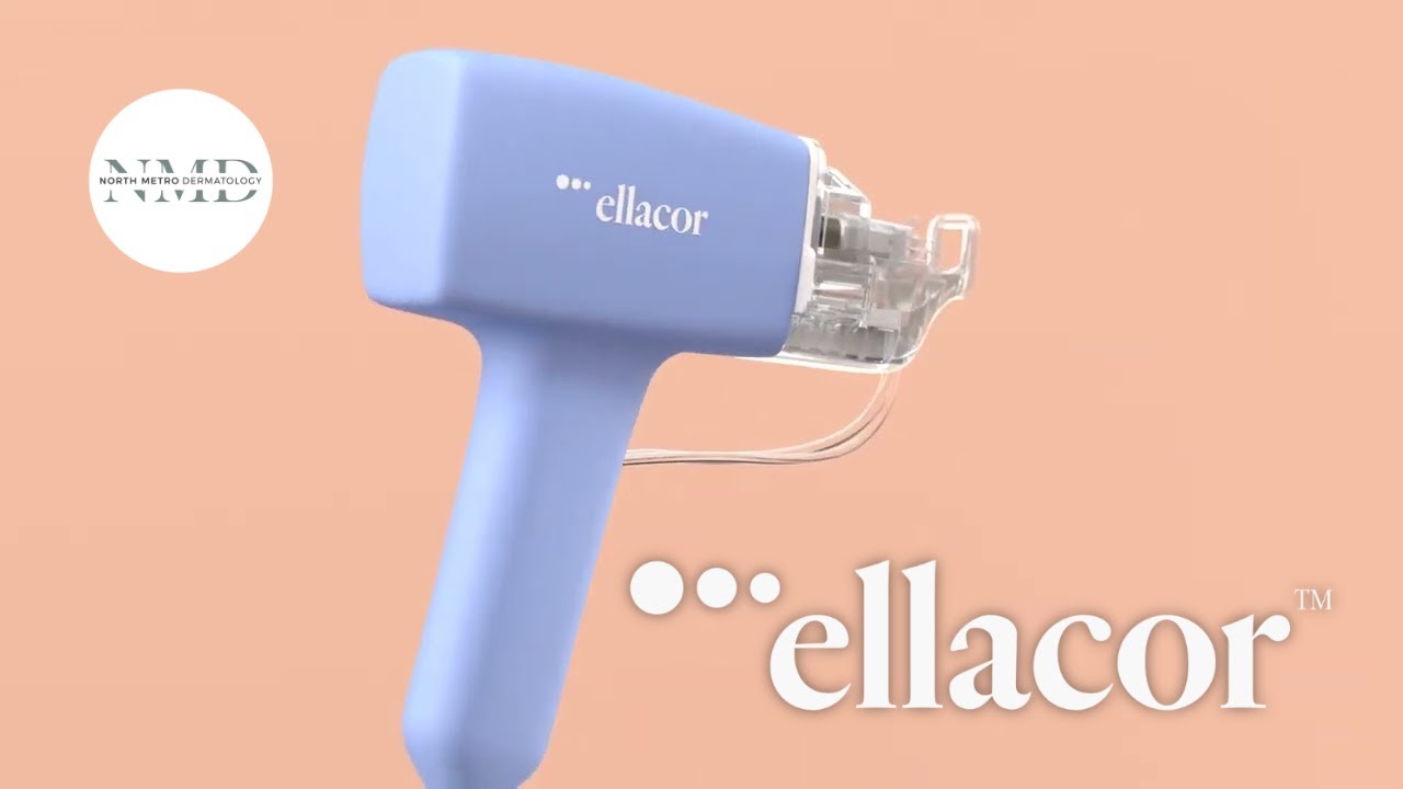 Ellacor Skin Tightening Treatment Youtube