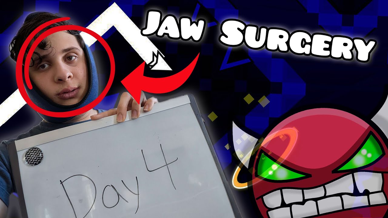 Beating Jawbreaker With A Broken Jaw Youtube