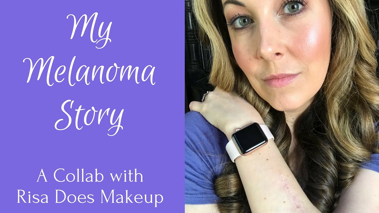 My Melanoma Story A Collaboration With Risa Does Makeup Part I Youtube