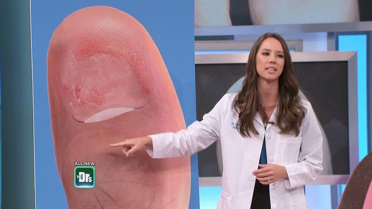 What To Do If Your Toenail Falls Off Youtube