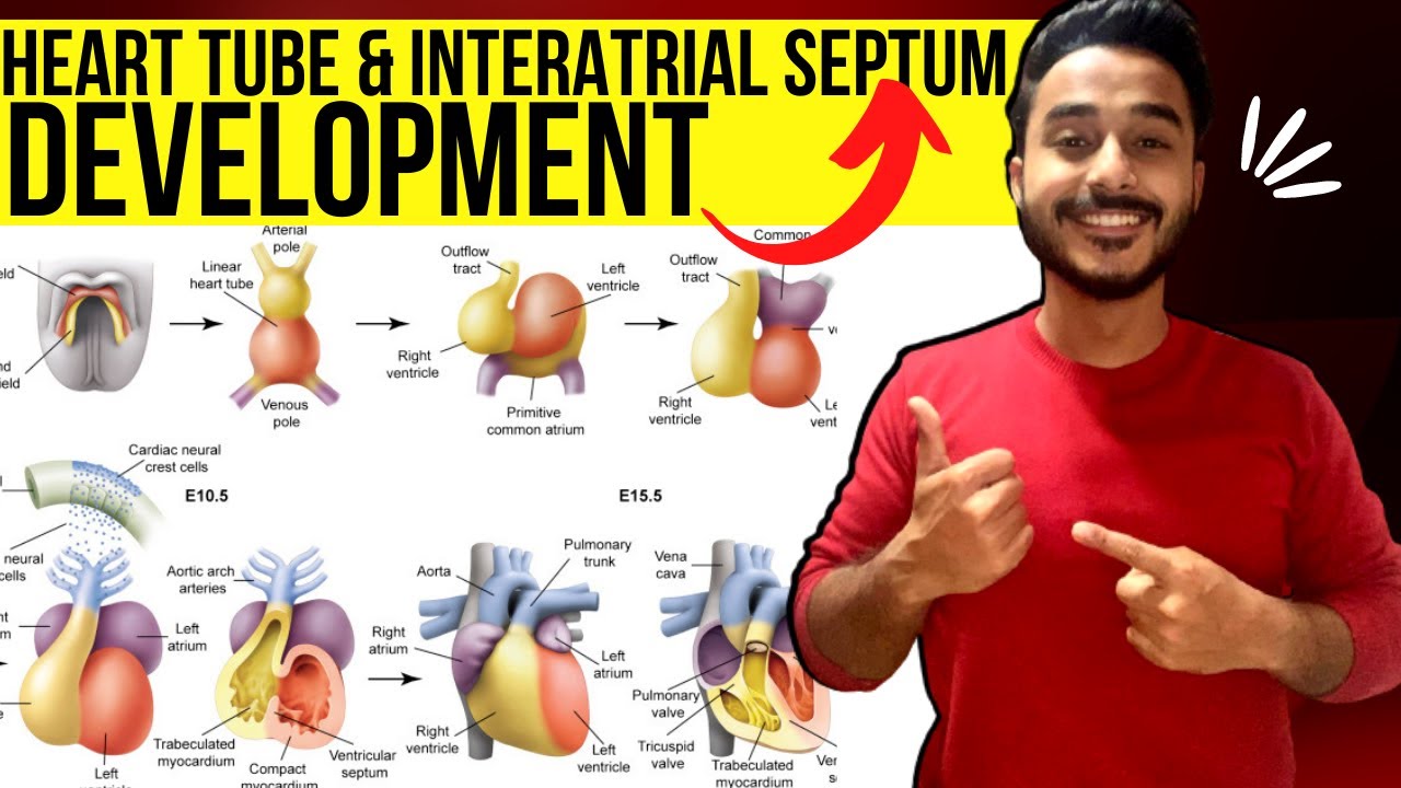 Interventricular Septum Embryology