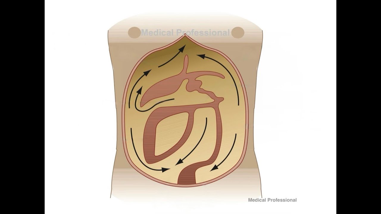 Intraperitoneal Spaces Youtube