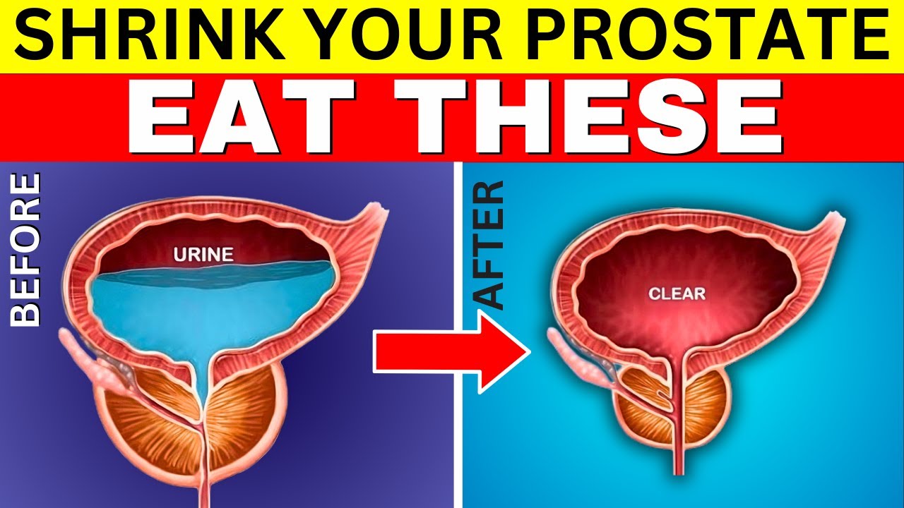 How To Shrink Your Prostate Naturally The 1 Nutrient You Need Youtube